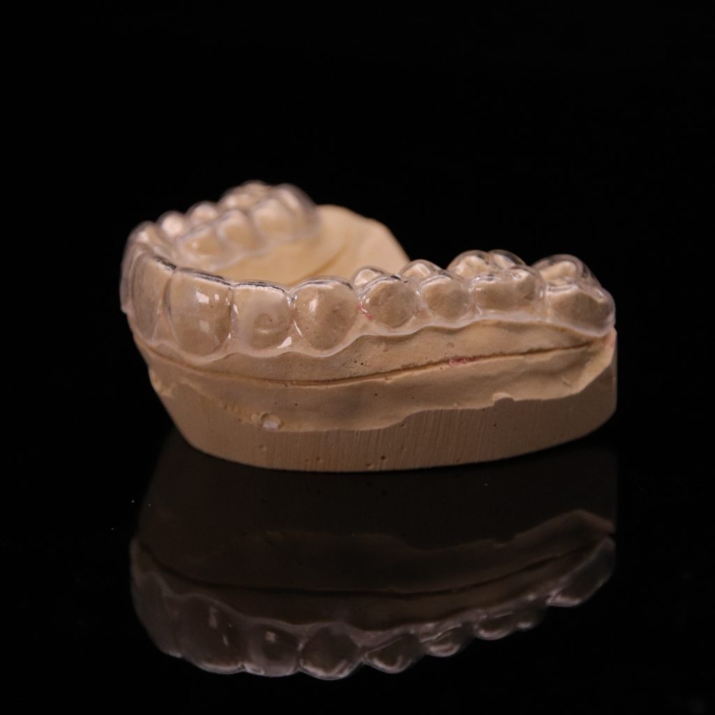 Clear Retainer China Dental Lab Dental Laboratory In China