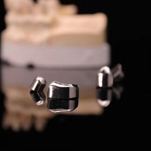 Telescope crowns – Dental Lab in China