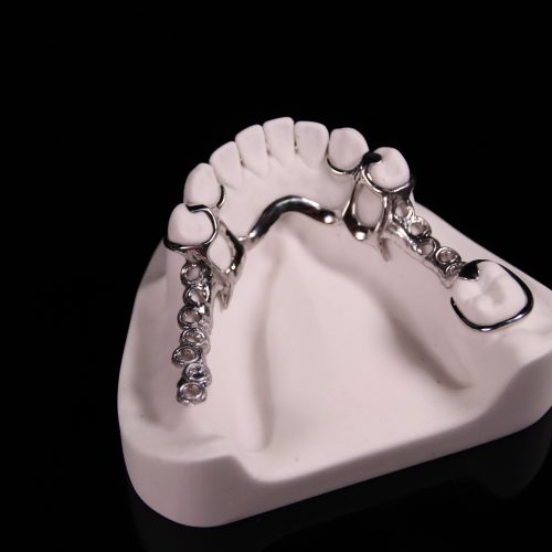 Removable Prosthetic – China Dental Lab