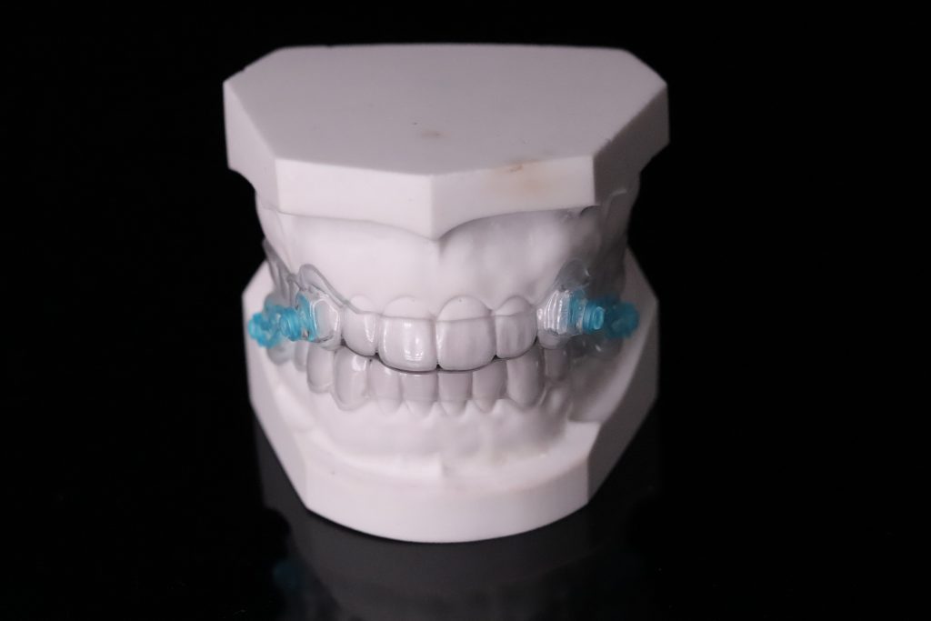 Erkodent silensor – A Premium China Dental Lab
