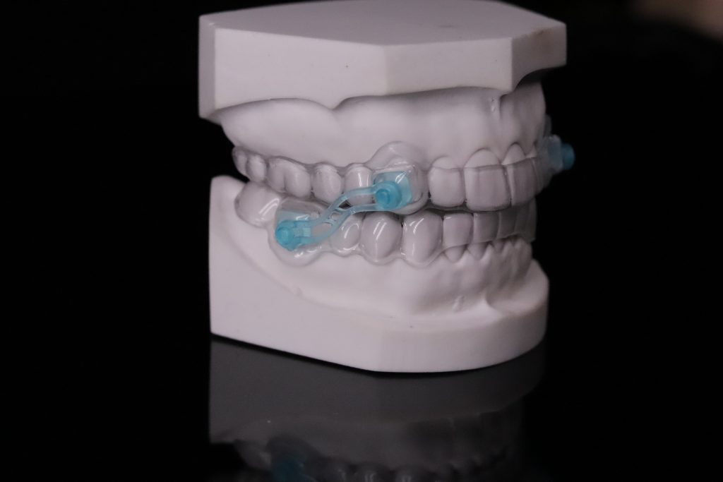 Erkodent silensor – A Premium China Dental Lab