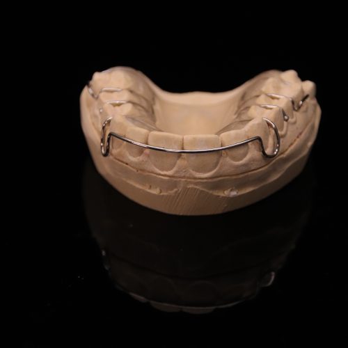 Hawley retainer – China Dental Lab